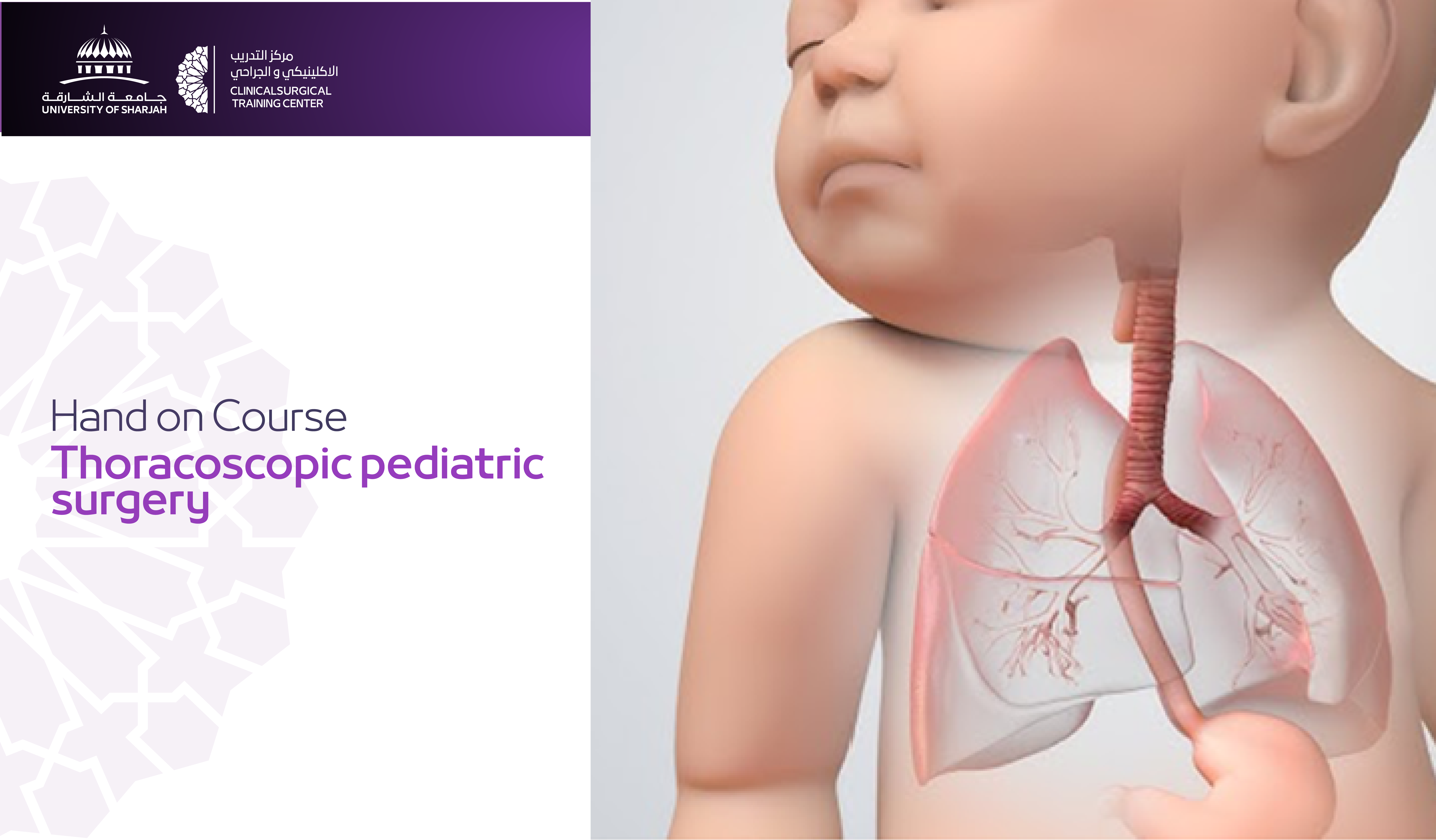 Hands on Thoracoscopic pediatric surgery 2